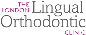 Countdown to the big event | The London Lingual Orthodontic Clinic